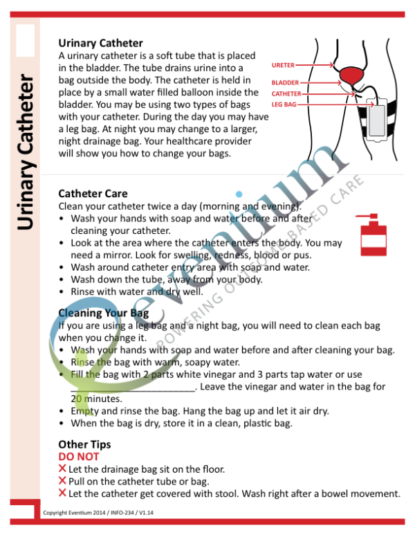 Urinary Catheter | Eventium
