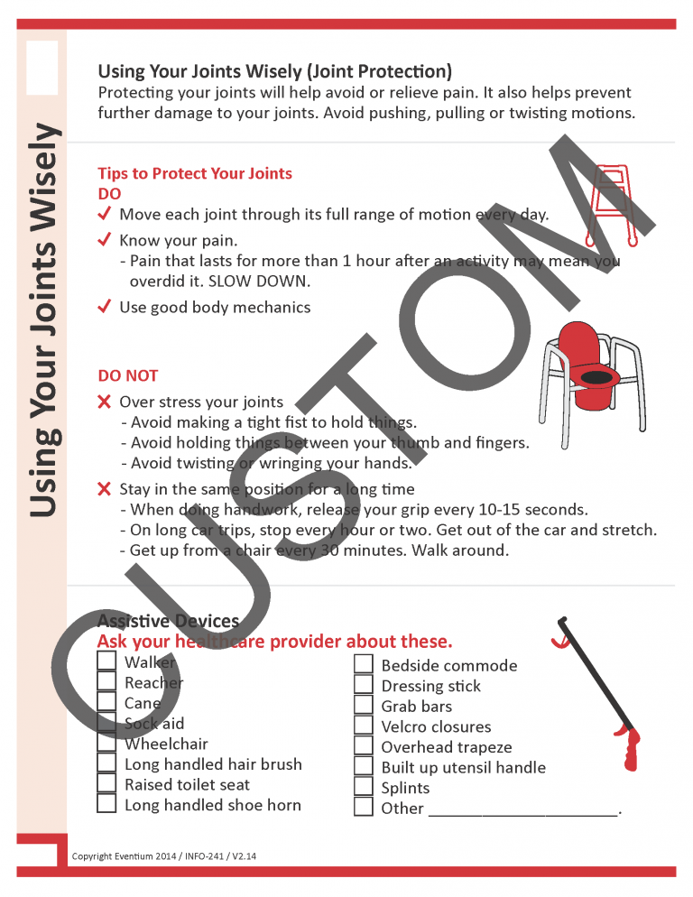 Joint Protection Custom | Eventium